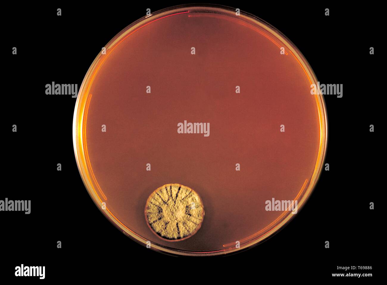 Dermatophyte hi-res stock photography and images - Alamy