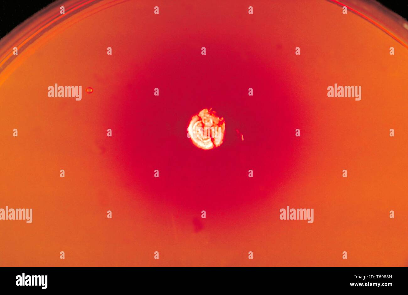 Close-up photograph of the Dermatophyte Test Medium (DTM) agar plate ...