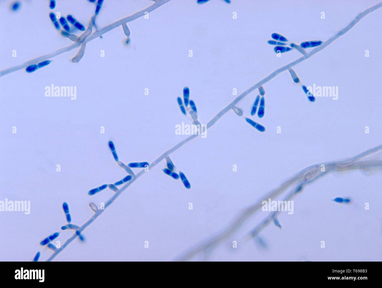 Conidiophores hi-res stock photography and images - Alamy