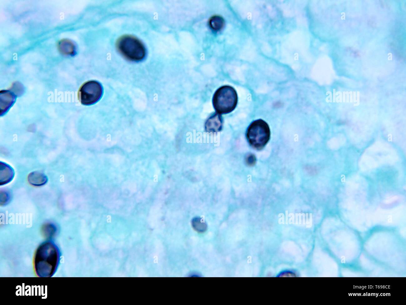Histoplasma hi-res stock photography and images - Alamy