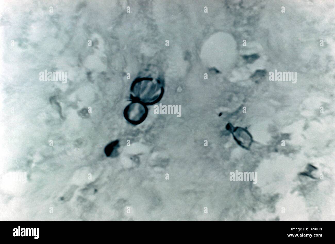 Methenamine silver stain photomicrograph of the histopathologic changes ...