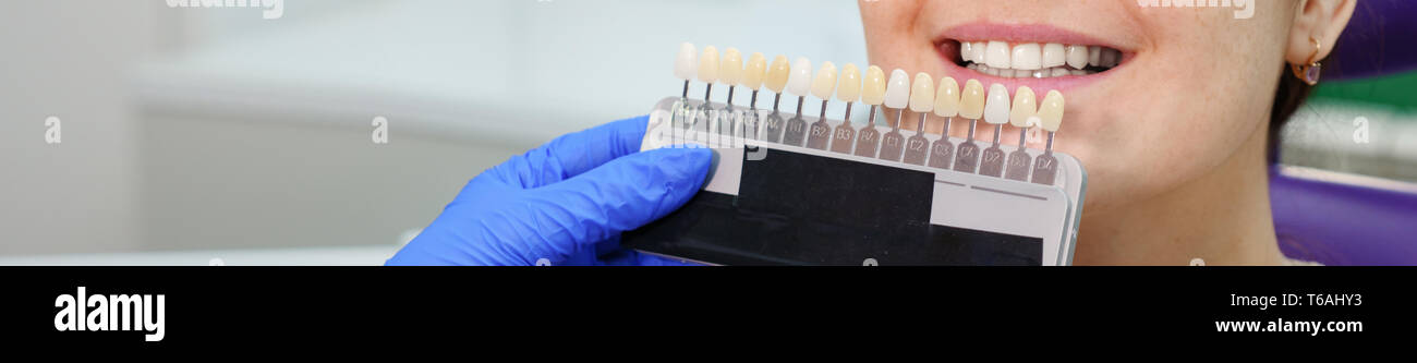 Dentist with tooth color samples is choosing shade for women patient ...