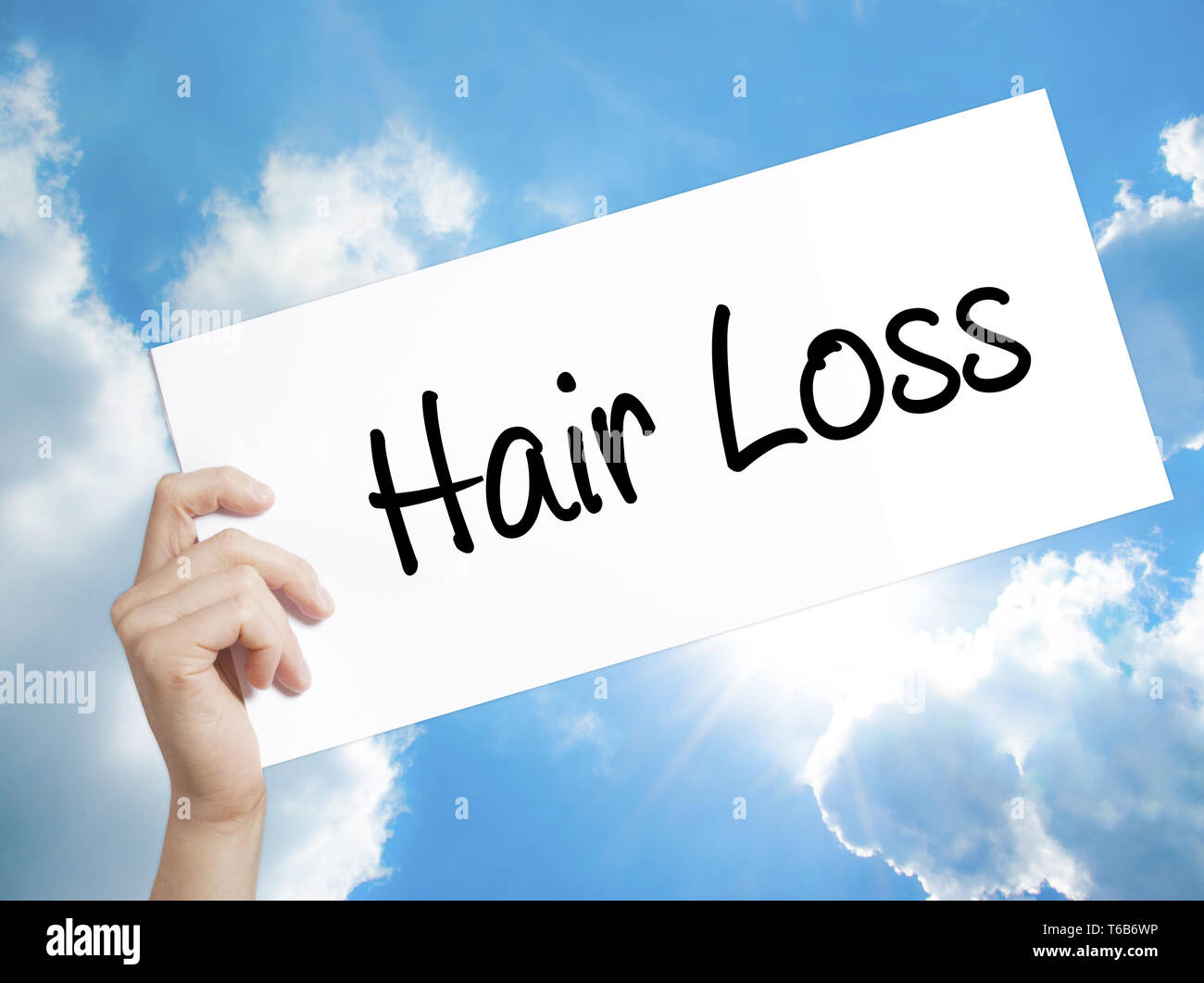 Hair Loss Sign on white paper. Man Hand Holding Paper with text ...