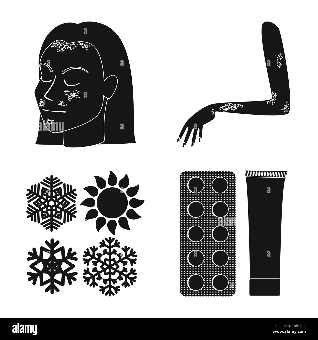 Skin rash sun allergy Black and White Stock Photos & Images - Alamy