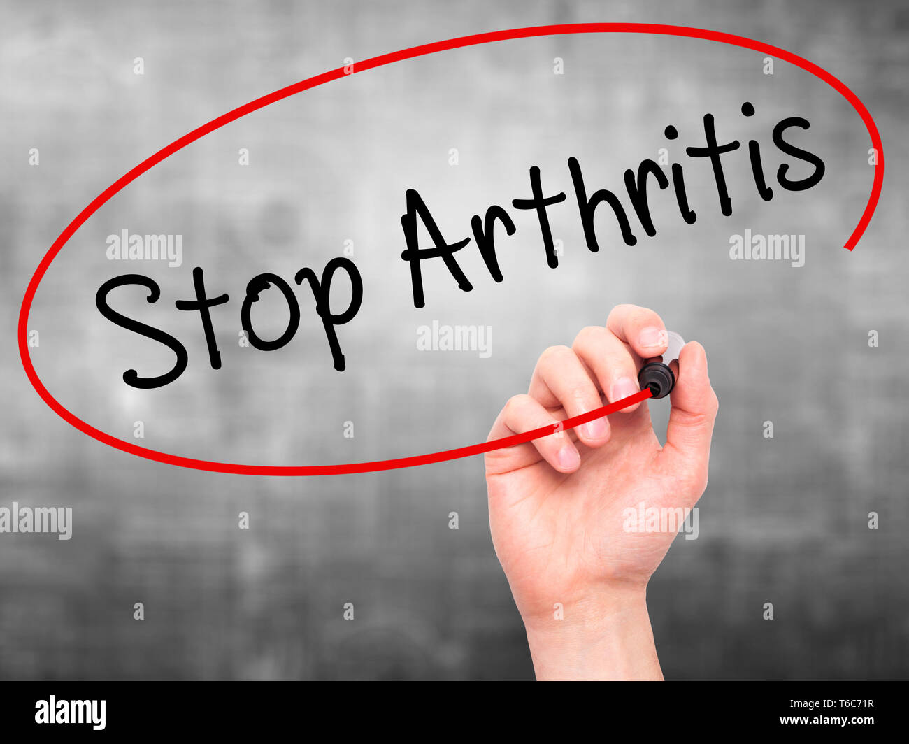 Hand osteoarthritis hi-res stock photography and images - Alamy