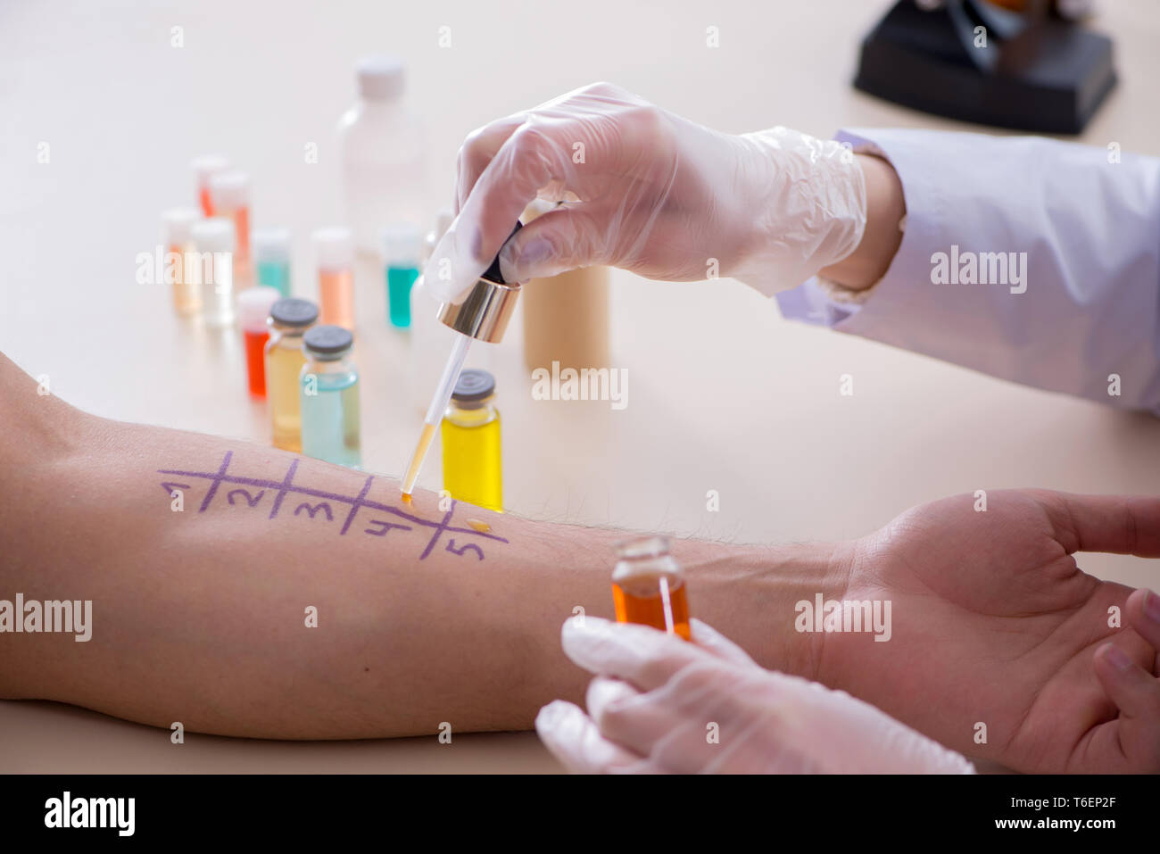 Doctor testing allergy reaction of patient in hospital Stock Photo - Alamy