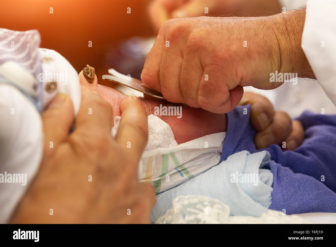 Male circumcision hi-res stock photography and images - Alamy