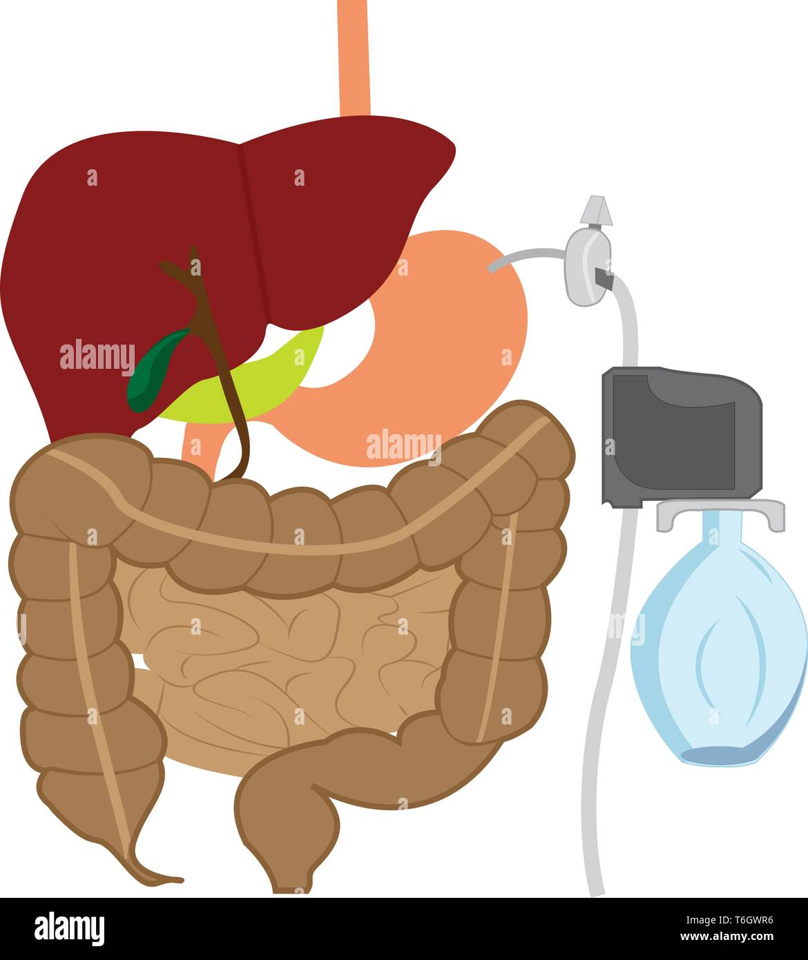 Aspire Assist for lose weight therapy vector illustration Stock Vector ...