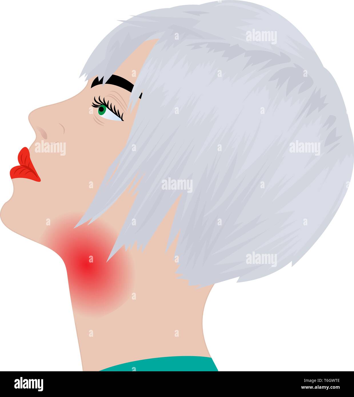 Throat pain. throat inflammation. flu. Medical vector illustration on a ...