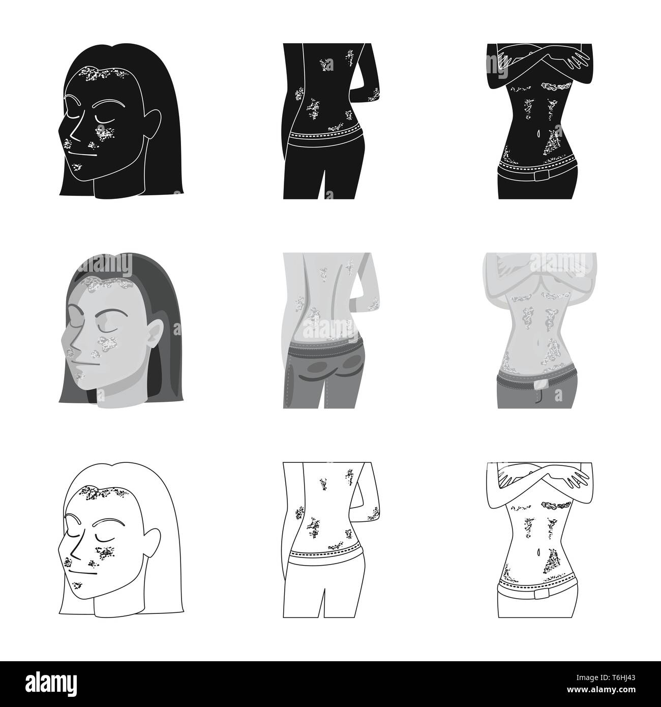 psoriasis,skin,body,chronic,allergy,eczema,itch,stress,rash,peeling ...