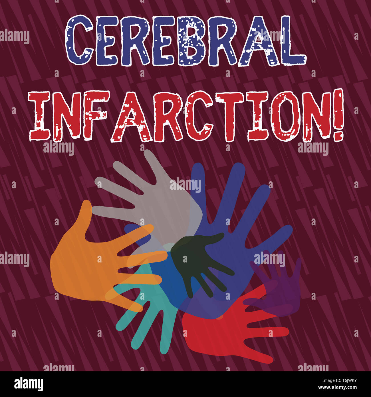 Text sign showing Cerebral Infarction. Business photo showcasing focal ...