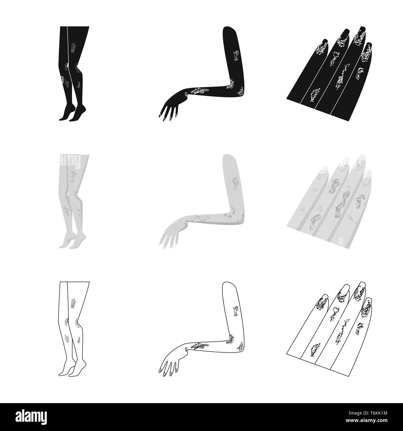 psoriasis,body,dermatitis,skin,eczema,rash,infection,itch,chronic,sick ...