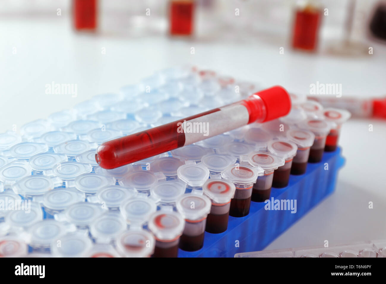 Test tubes with blood samples in holder, closeup Stock Photo - Alamy