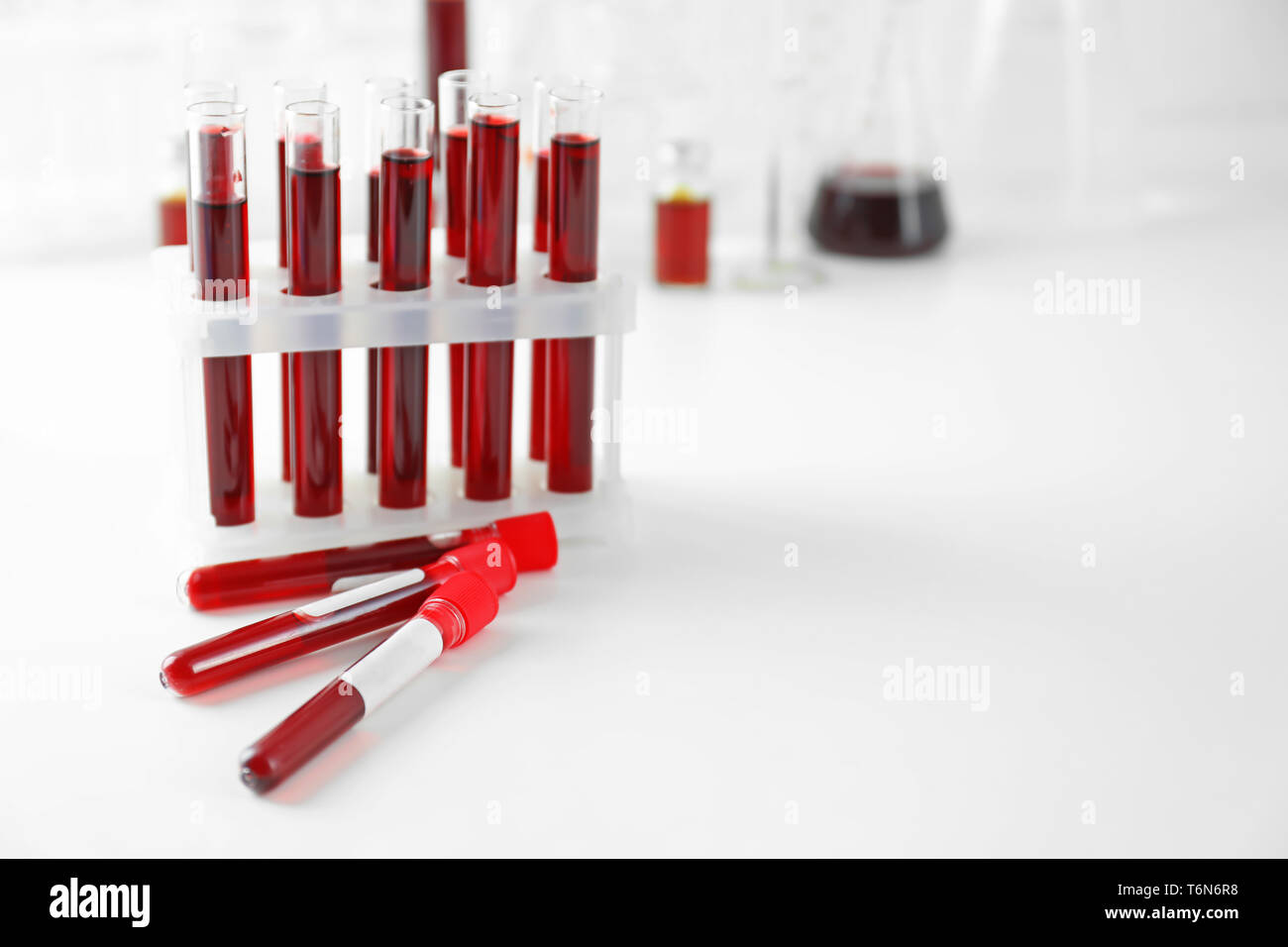 Blood specimen tubes on hi-res stock photography and images - Alamy