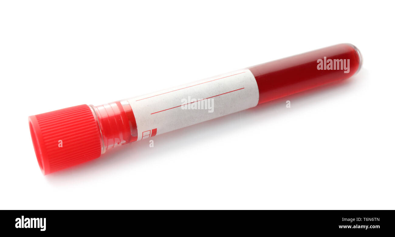 Test tube with blood samples on white background Stock Photo - Alamy