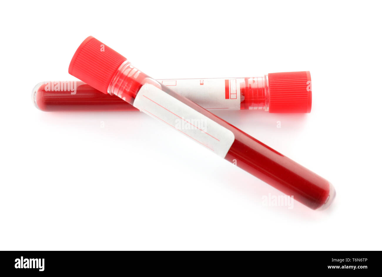 Test tubes with blood samples on white background Stock Photo - Alamy