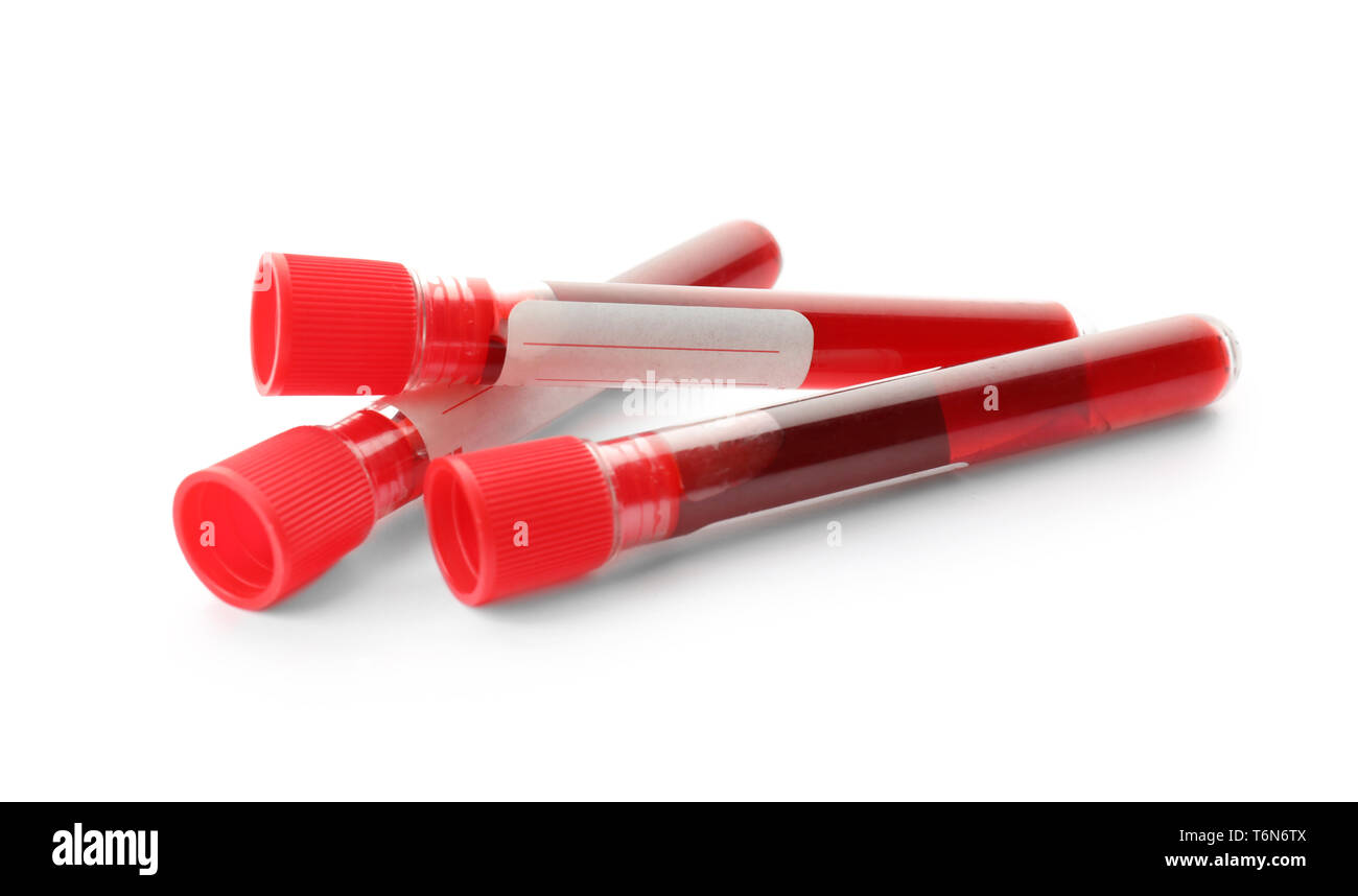 Test tubes with blood samples on white background Stock Photo - Alamy