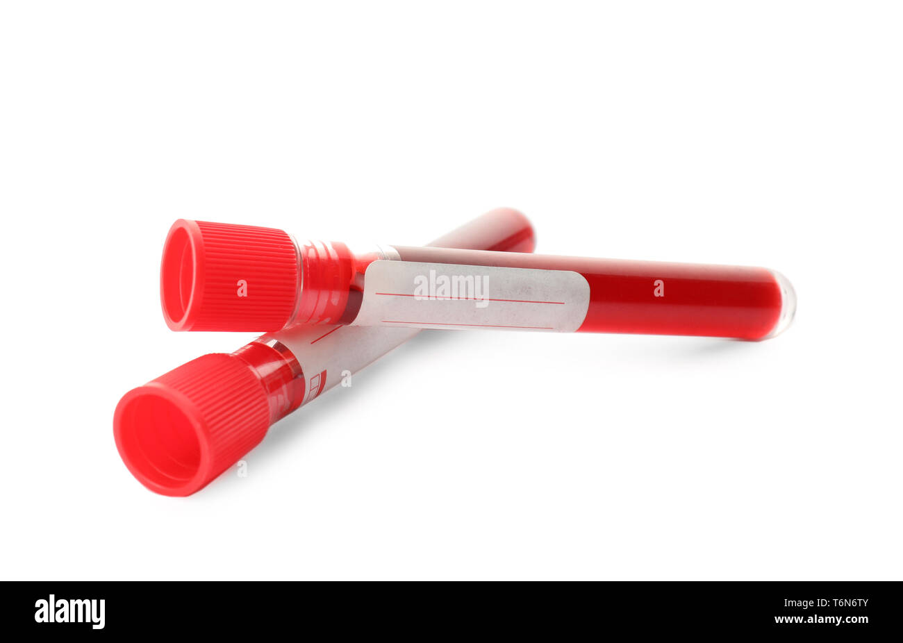 Test tubes with blood samples on white background Stock Photo - Alamy