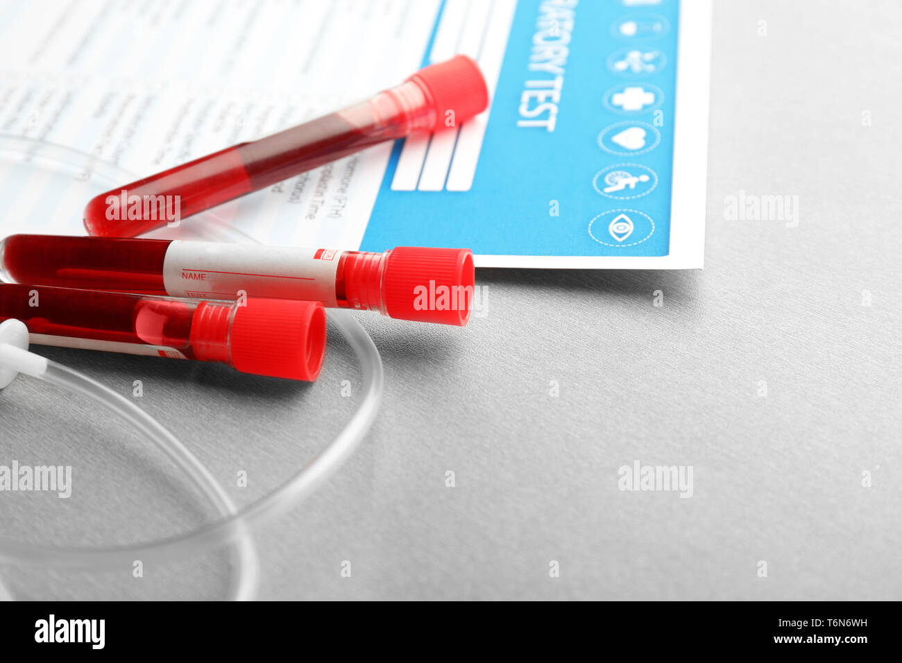 Test tubes with blood samples and medical equipment on light background ...