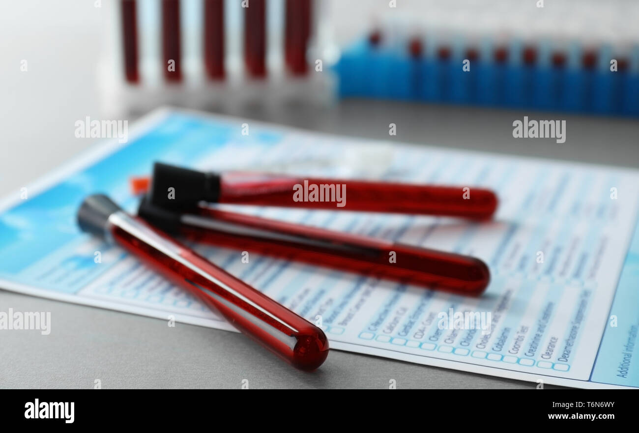 Test tubes with blood samples and form on table Stock Photo - Alamy