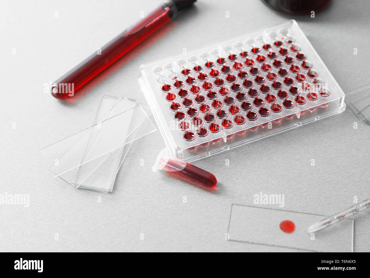 Glass and test tubes with blood samples on table Stock Photo - Alamy