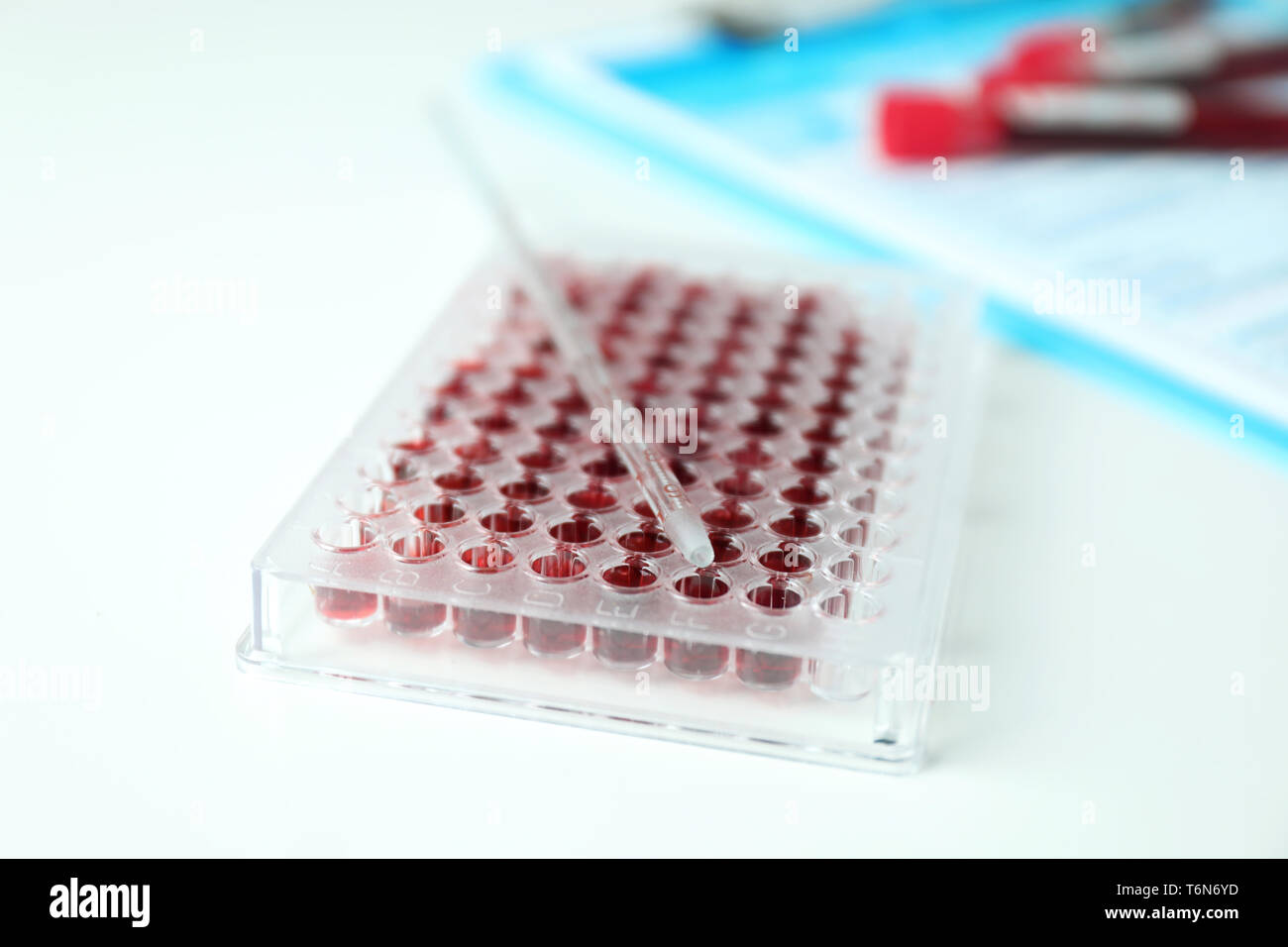 Test tubes with blood samples in holder on table Stock Photo - Alamy