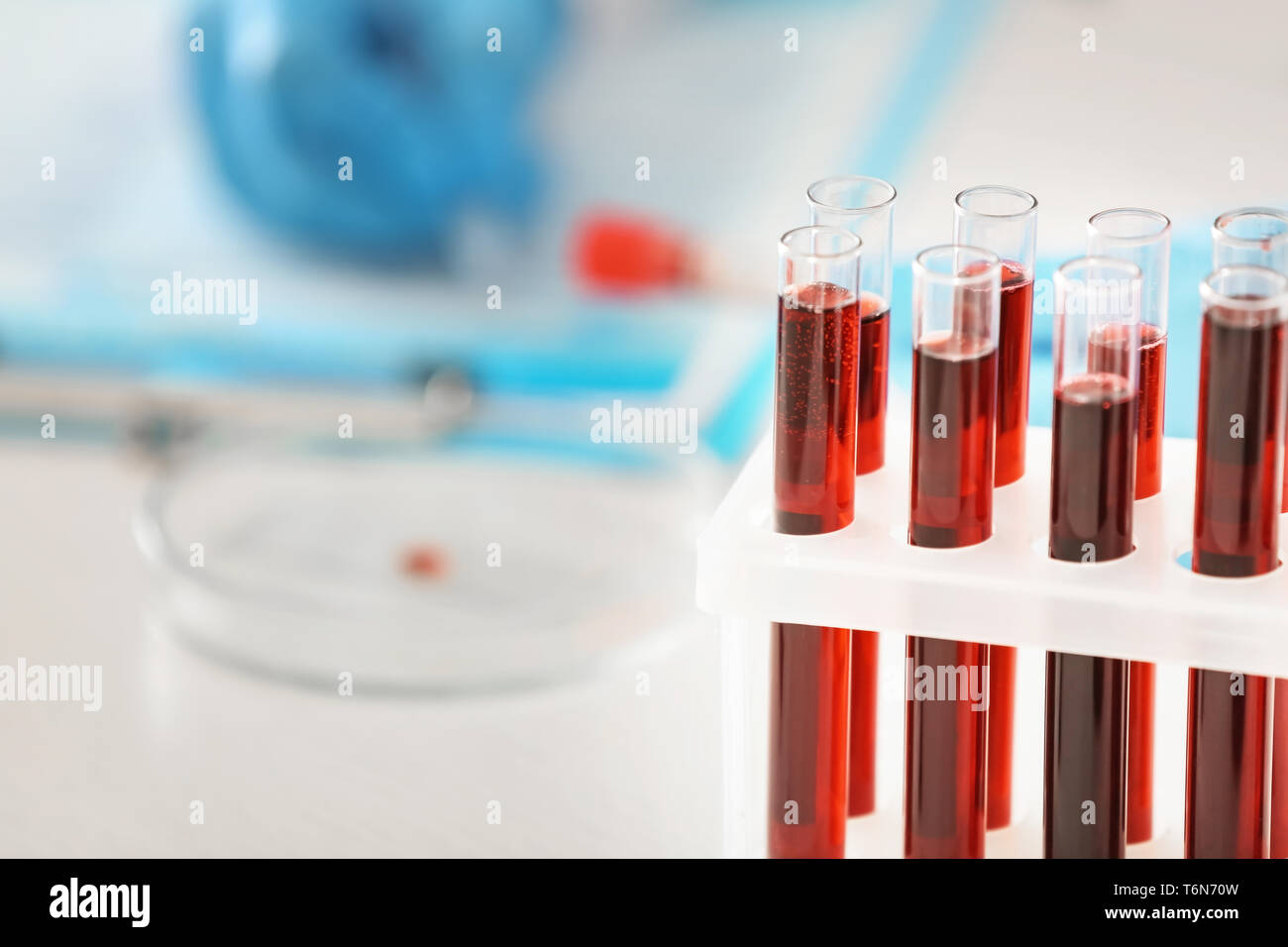 Test tubes with blood samples in holder and blurred lab worker on ...
