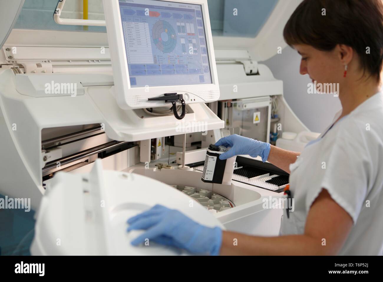 Icterus analyser hi-res stock photography and images - Alamy