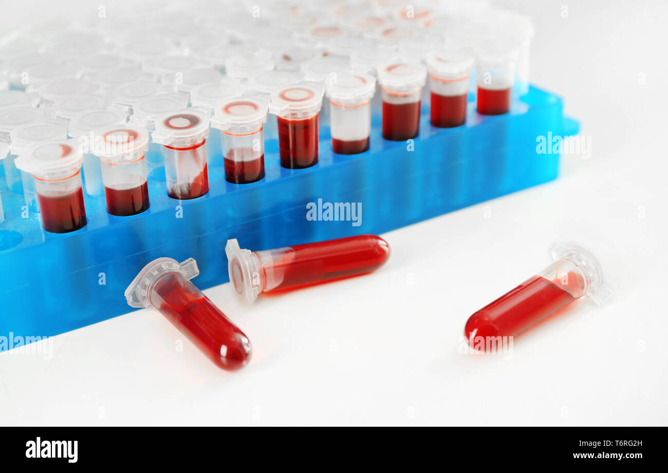 Blood specimen tubes on hi-res stock photography and images - Alamy