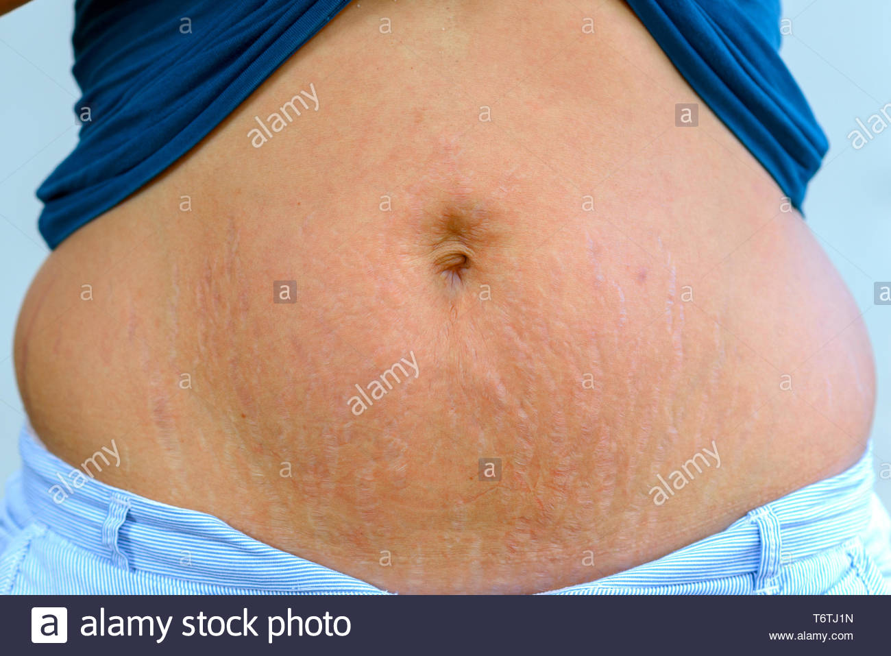 Woman Belly Button Stock Photos & Woman Belly Button Stock Images - Alamy