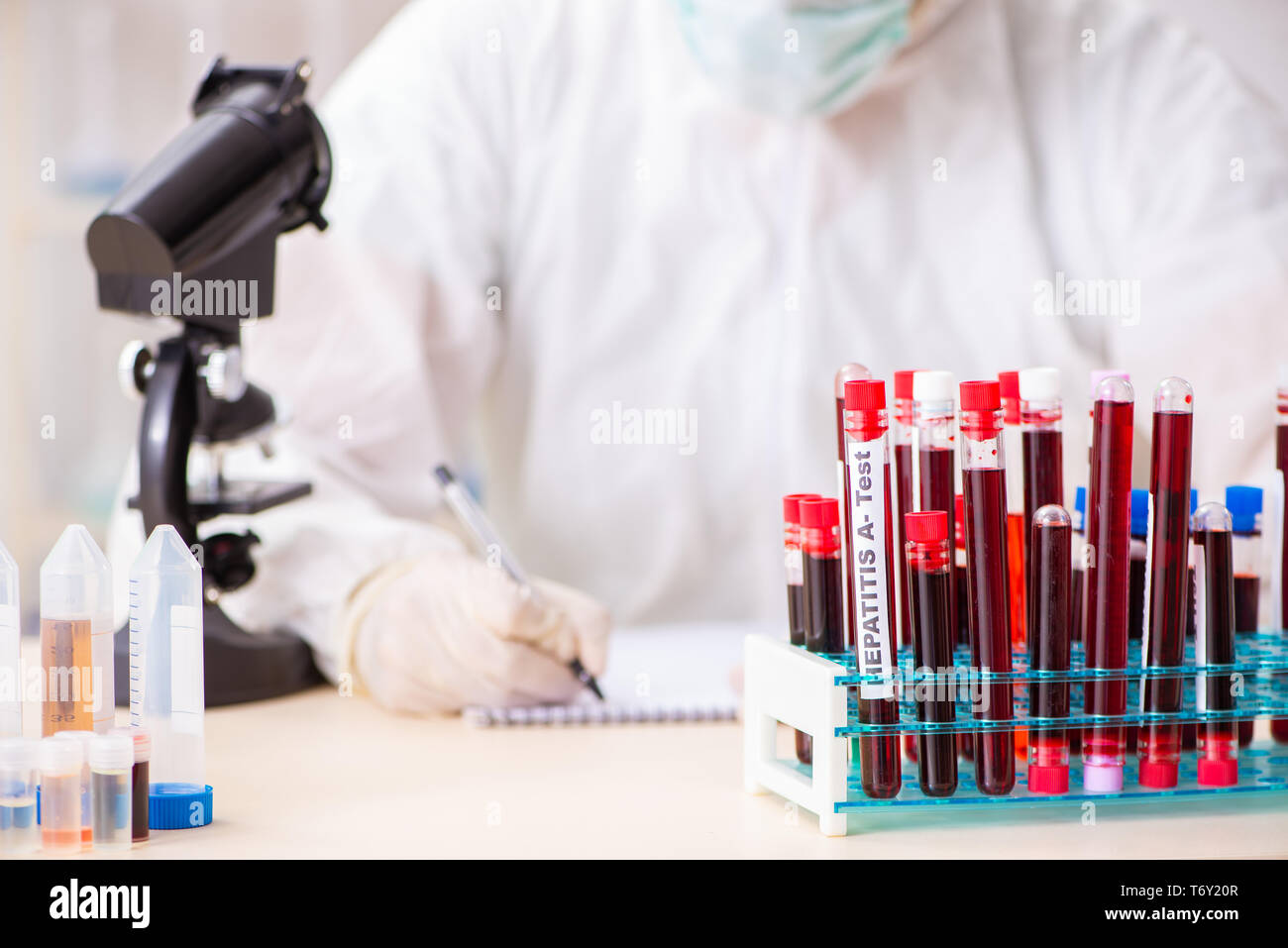The young handsome lab assistant testing blood samples in hospital ...