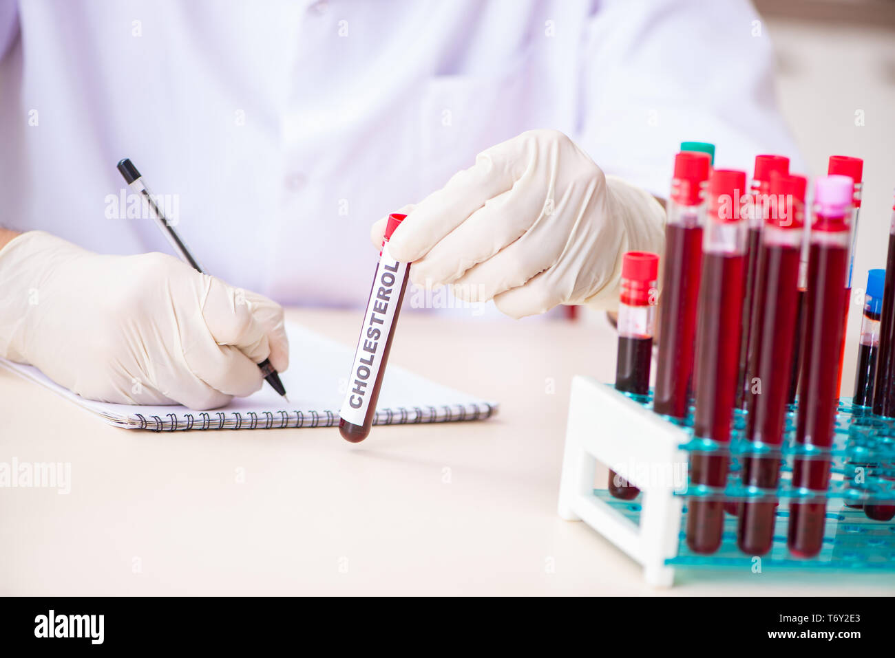 The young handsome lab assistant testing blood samples in hospital ...