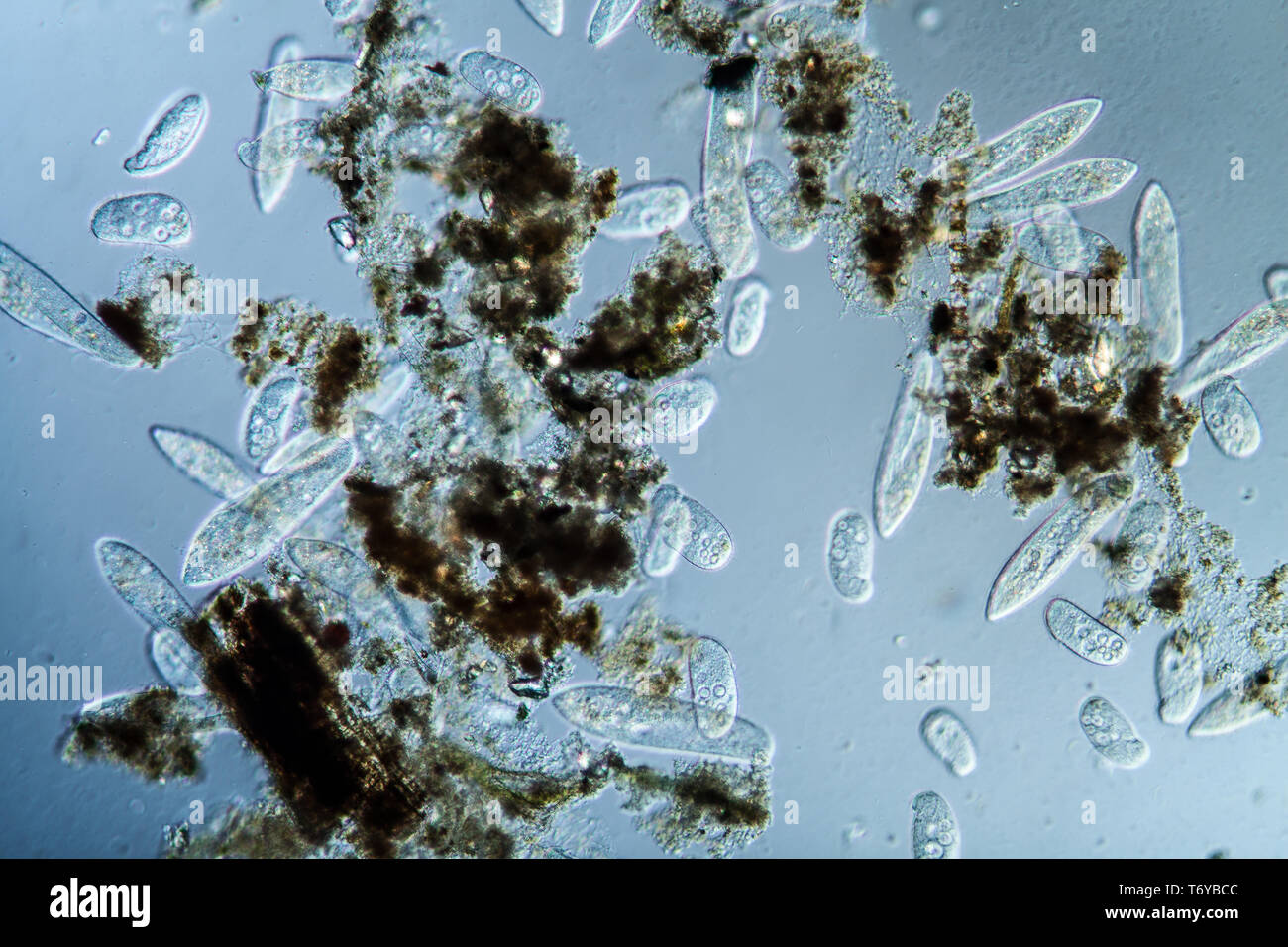 Plankton with ciliates Stock Photo - Alamy