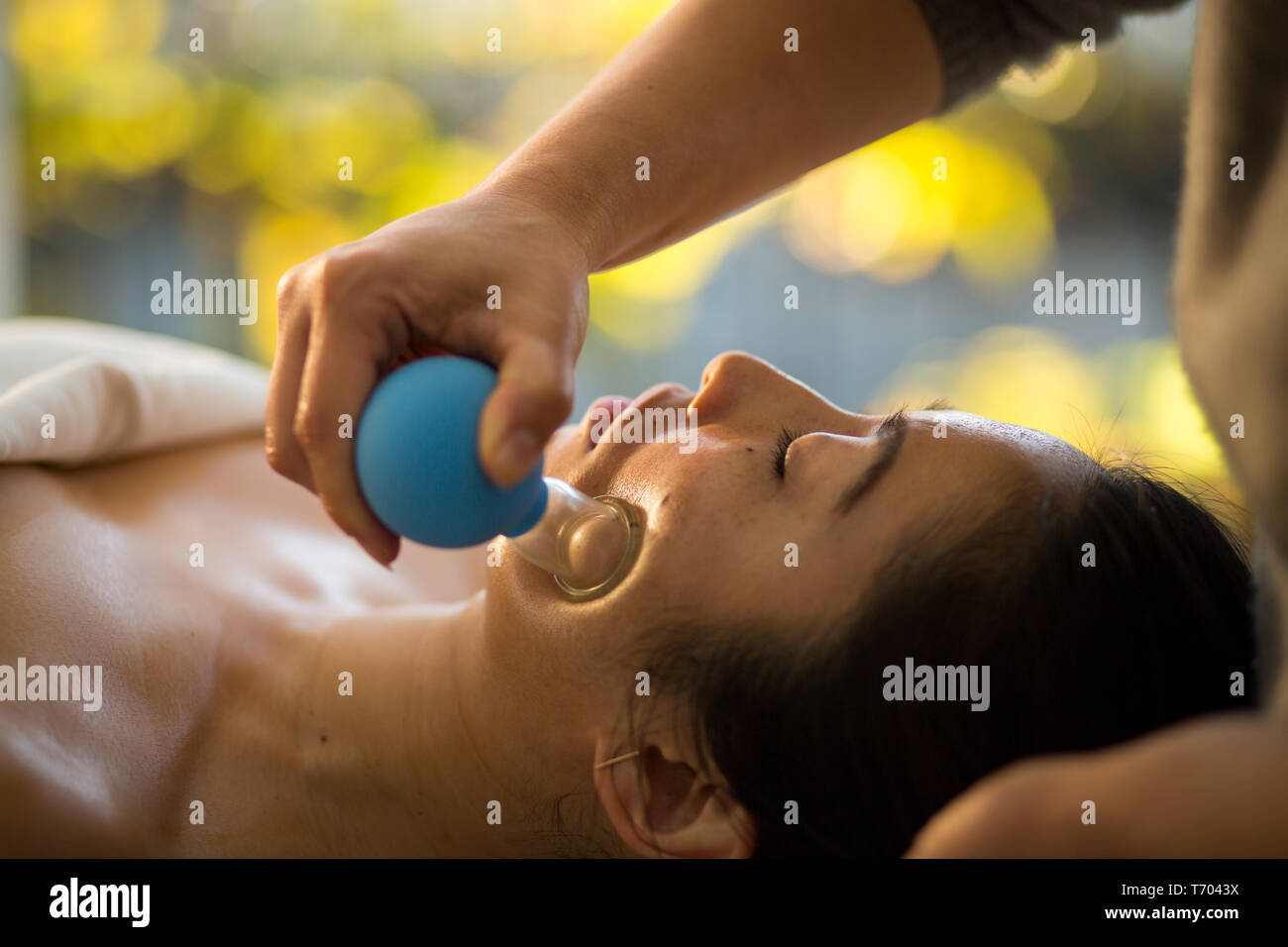 Cupping massage hi-res stock photography and images - Alamy