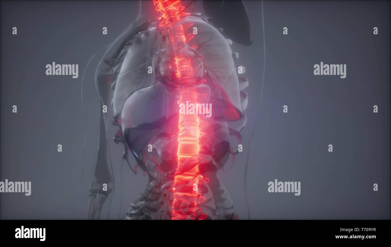 Hurt Spine. Male Backbone. Backache Stock Photo - Alamy