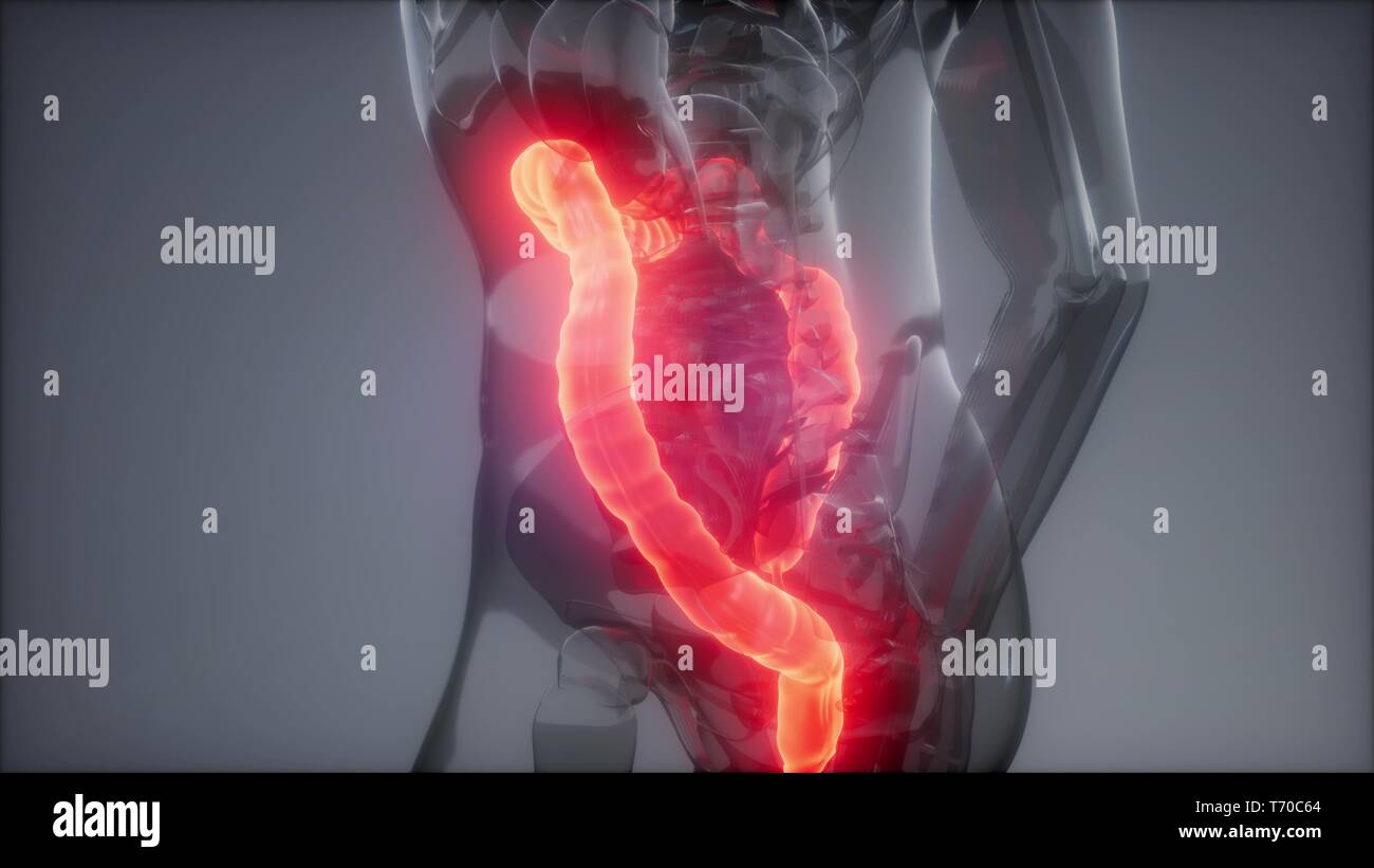 Transverse colon hi-res stock photography and images - Alamy