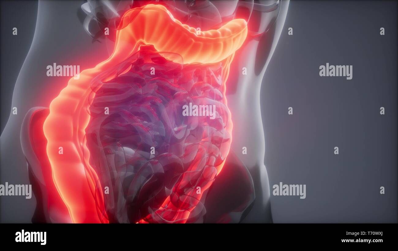 Haustra of colon hi-res stock photography and images - Alamy