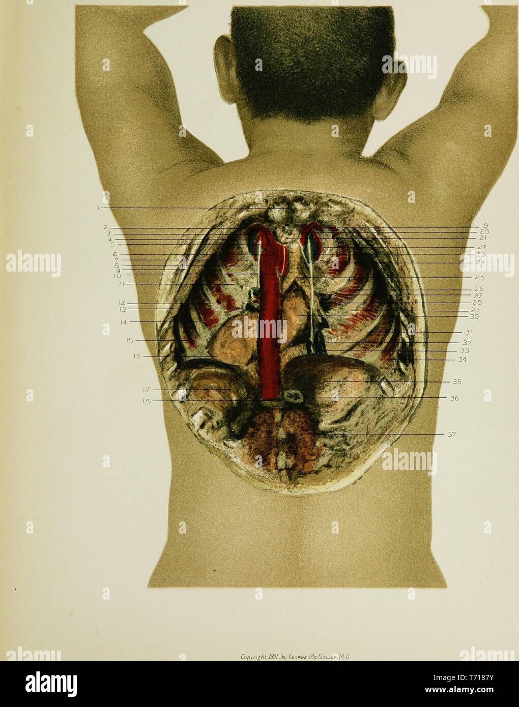 Surgical equipment historical hi-res stock photography and images - Alamy