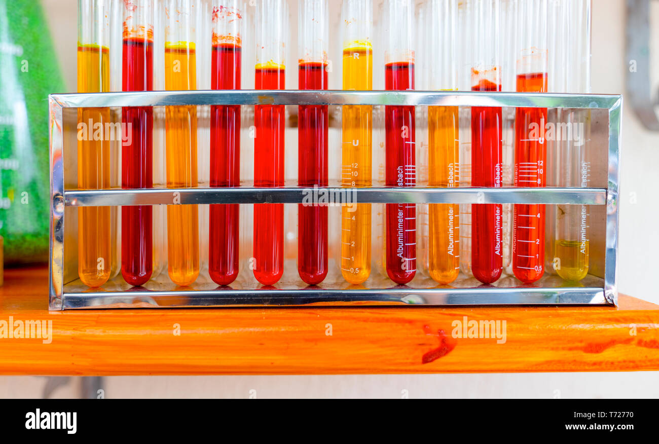 Blood test tubes hi-res stock photography and images - Alamy