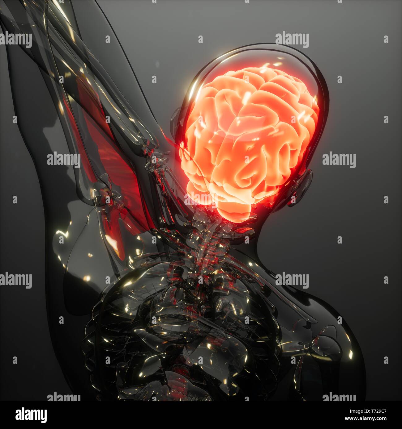 Human Brain Radiology Exam Stock Photo - Alamy