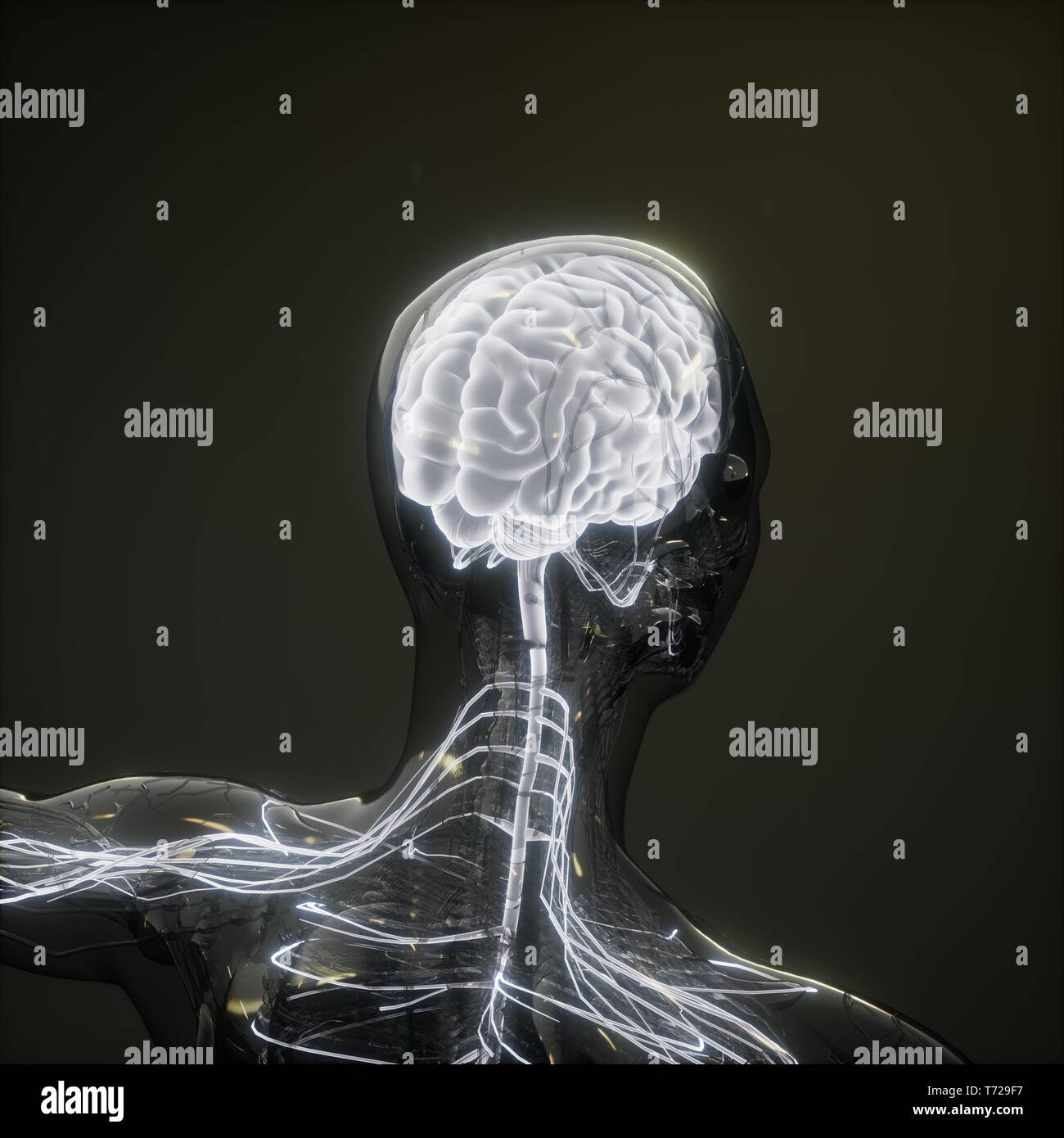 Human Brain Radiology Exam Stock Photo - Alamy