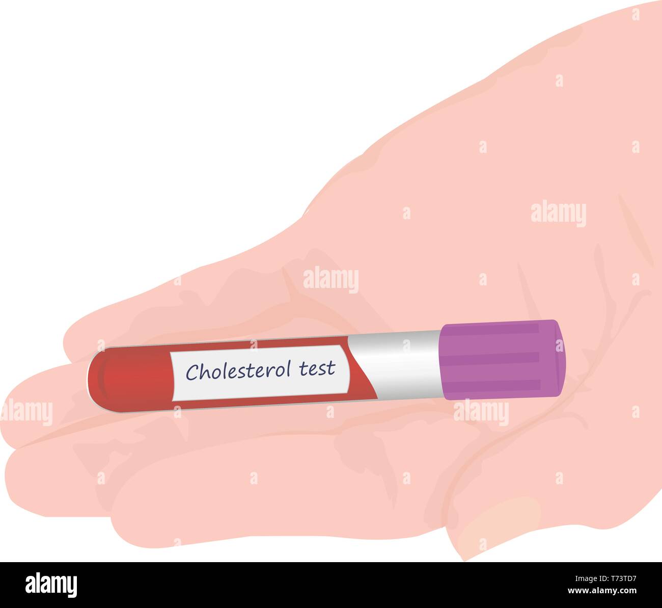 Blood cholesterol test vector illustration Stock Vector Image & Art - Alamy