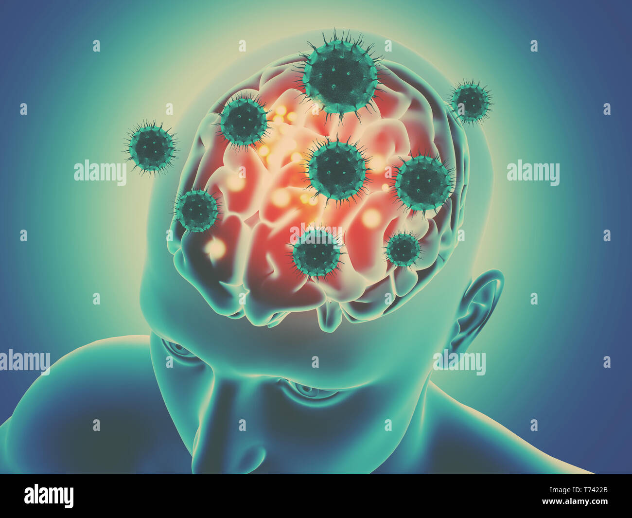 3D render of a male figure with brain being attached by virus cells ...