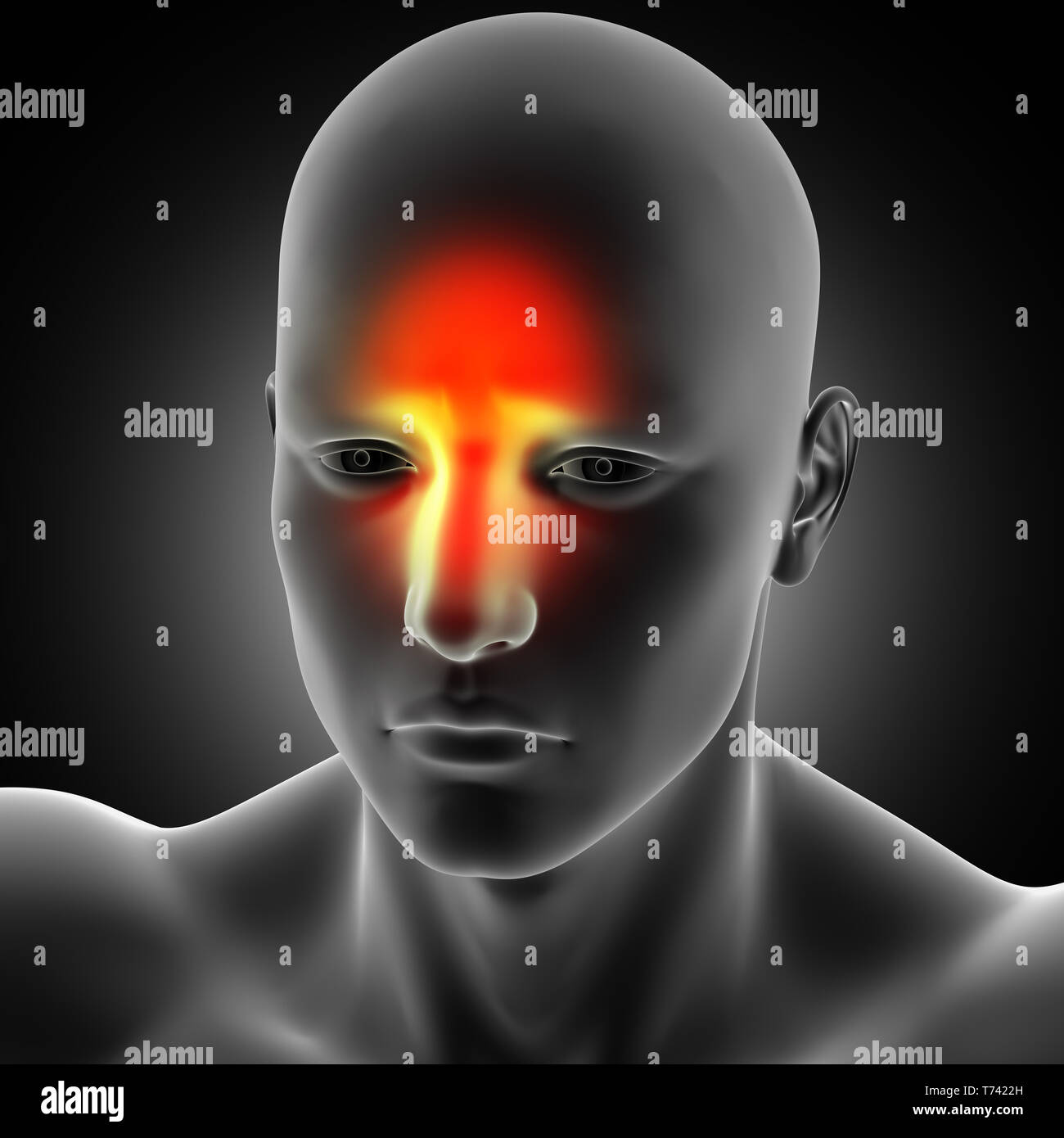 3D render of a male medical figure showing headache and sinus pain ...