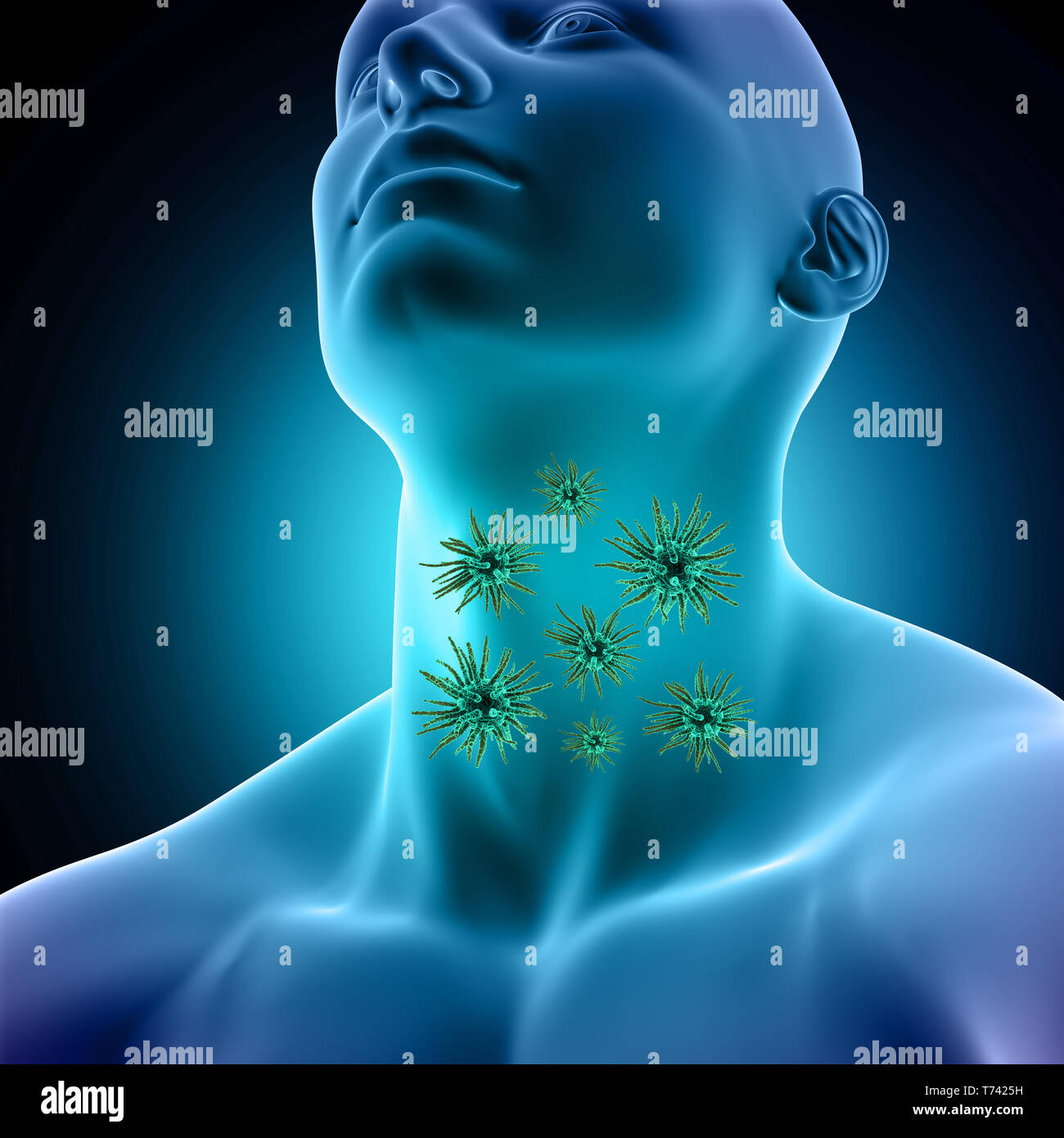 3D render of a male medical figure with virus cells on sore throat ...