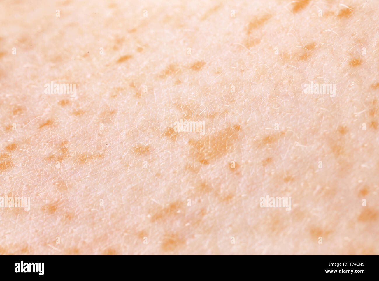 Texture of skin, closeup Stock Photo - Alamy