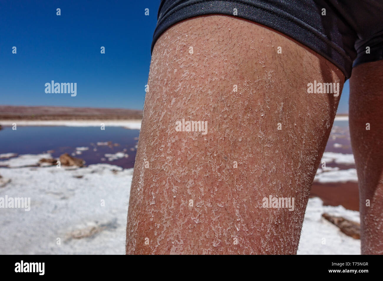 Man leg with salt after swimming in Atacama salt lakes Stock Photo - Alamy