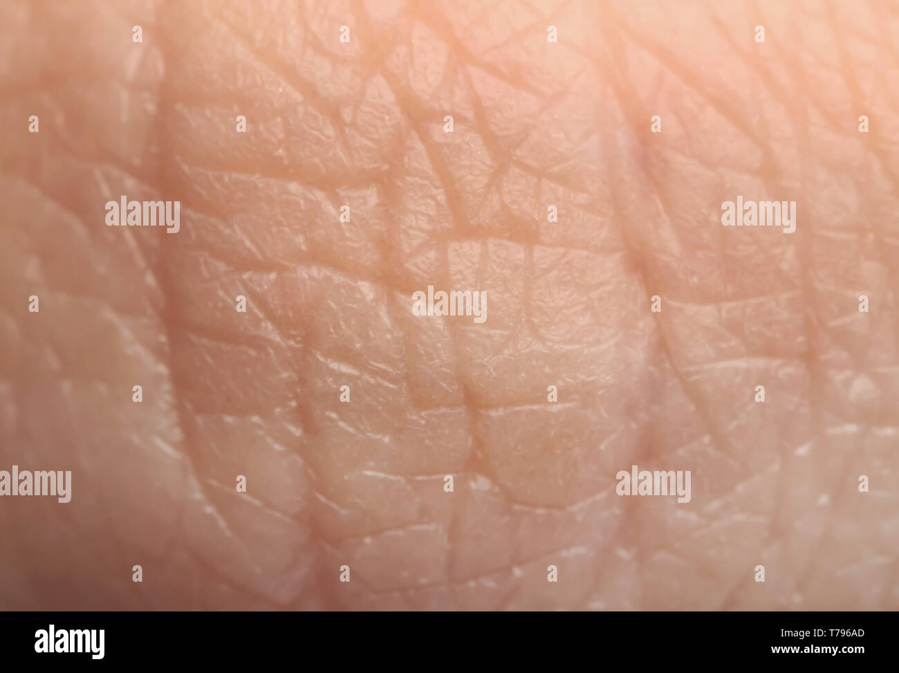 Texture of human skin, closeup Stock Photo - Alamy