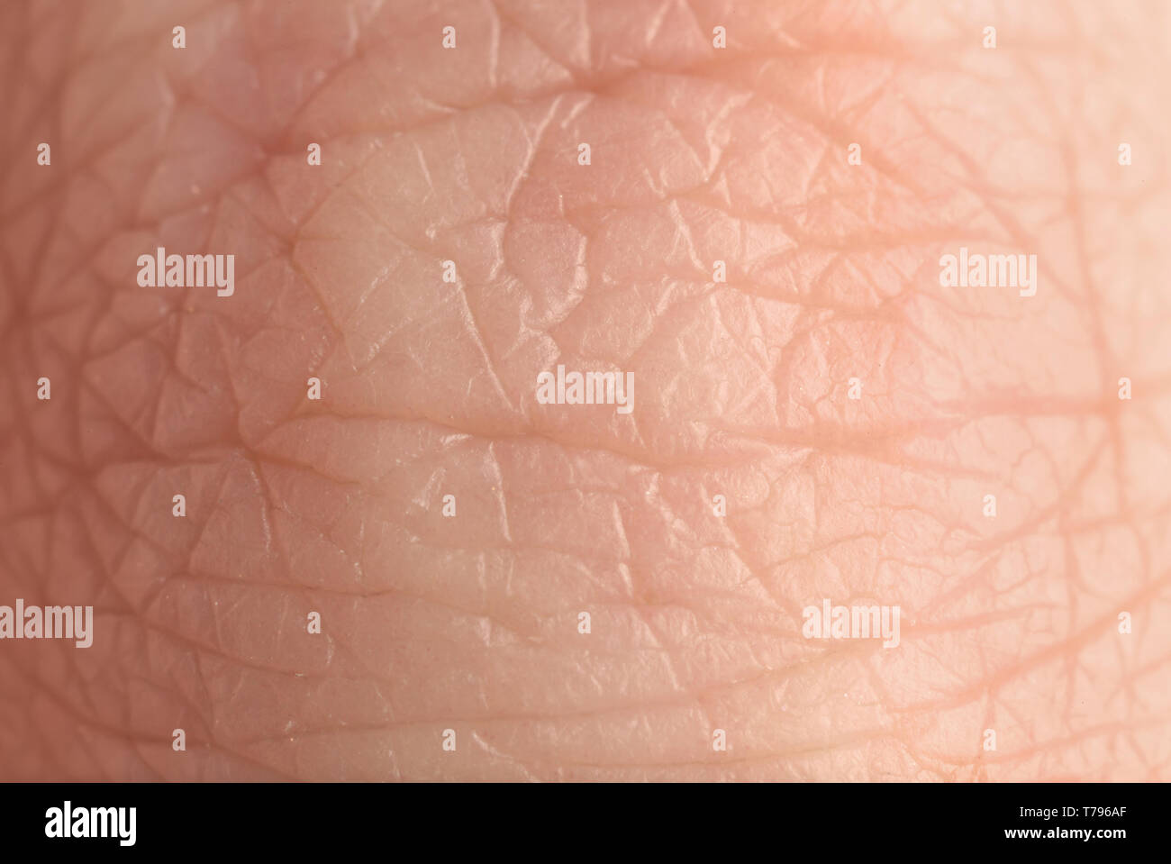 Texture of human skin, closeup Stock Photo - Alamy