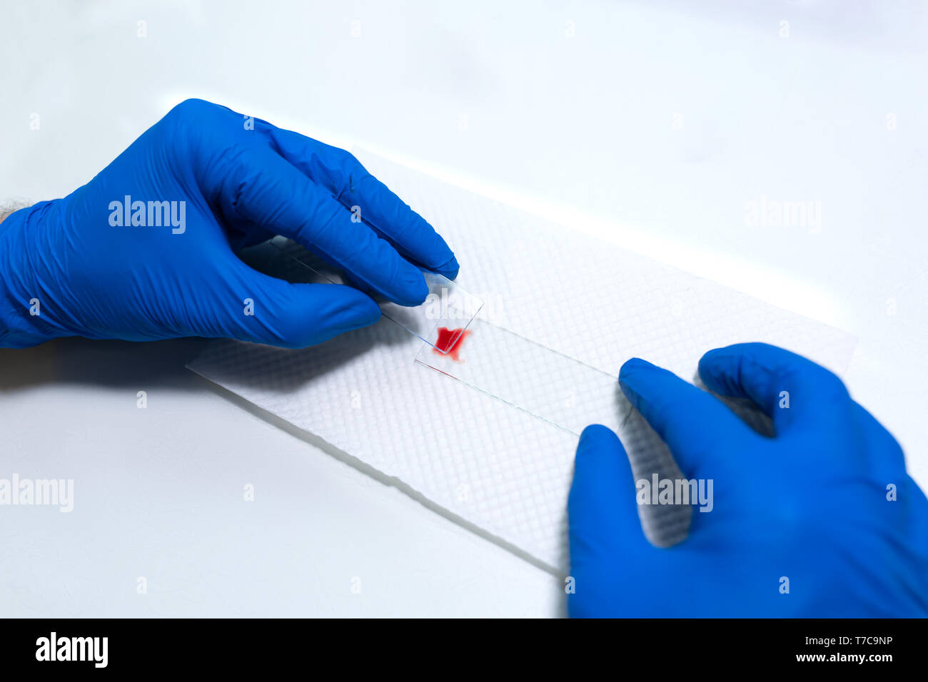 scientist prepare blood sample for research on microscope. Placing ...